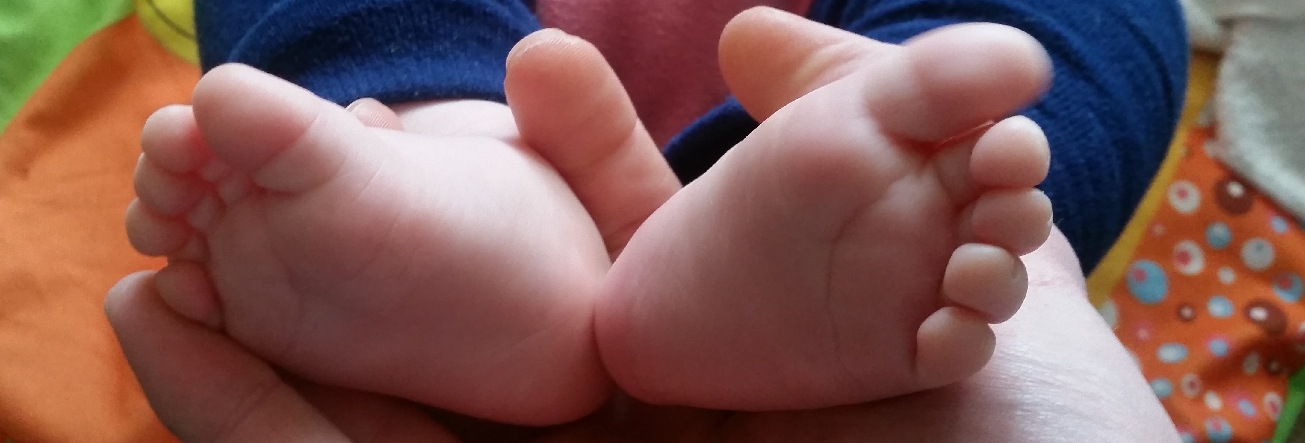 Curly toes – Podiatry on Williamson